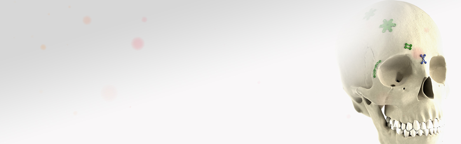 Upper two-thirds Plates of Minitek-Microtek Range - Global D